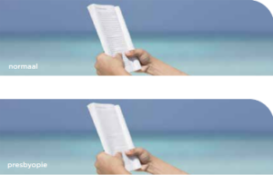 Behandelingen bij vermindering van het zicht